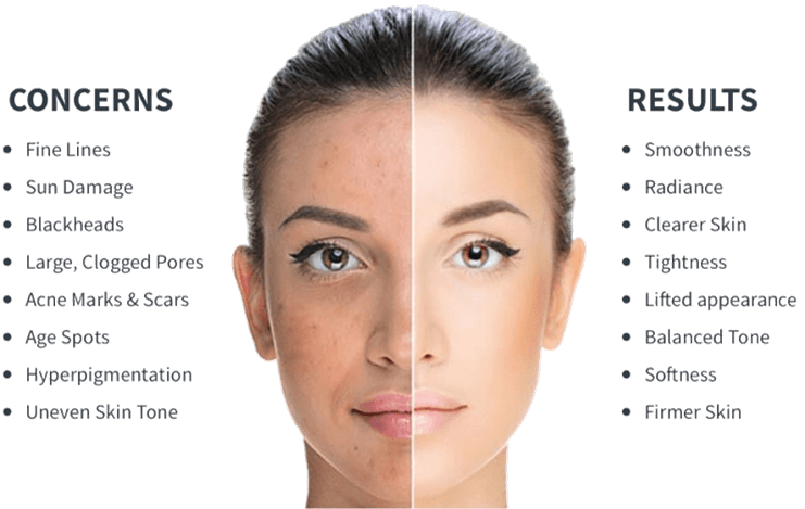 Face Acids! – Spa With Rutu